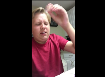 Most Forehead Hits With A Lip Balm | World Record | Jake Smith